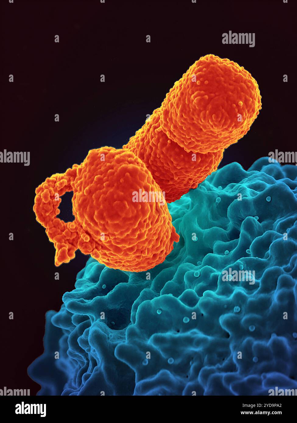 A human neutrophil interacting with Klebsiella pneumoniae orange, a ...