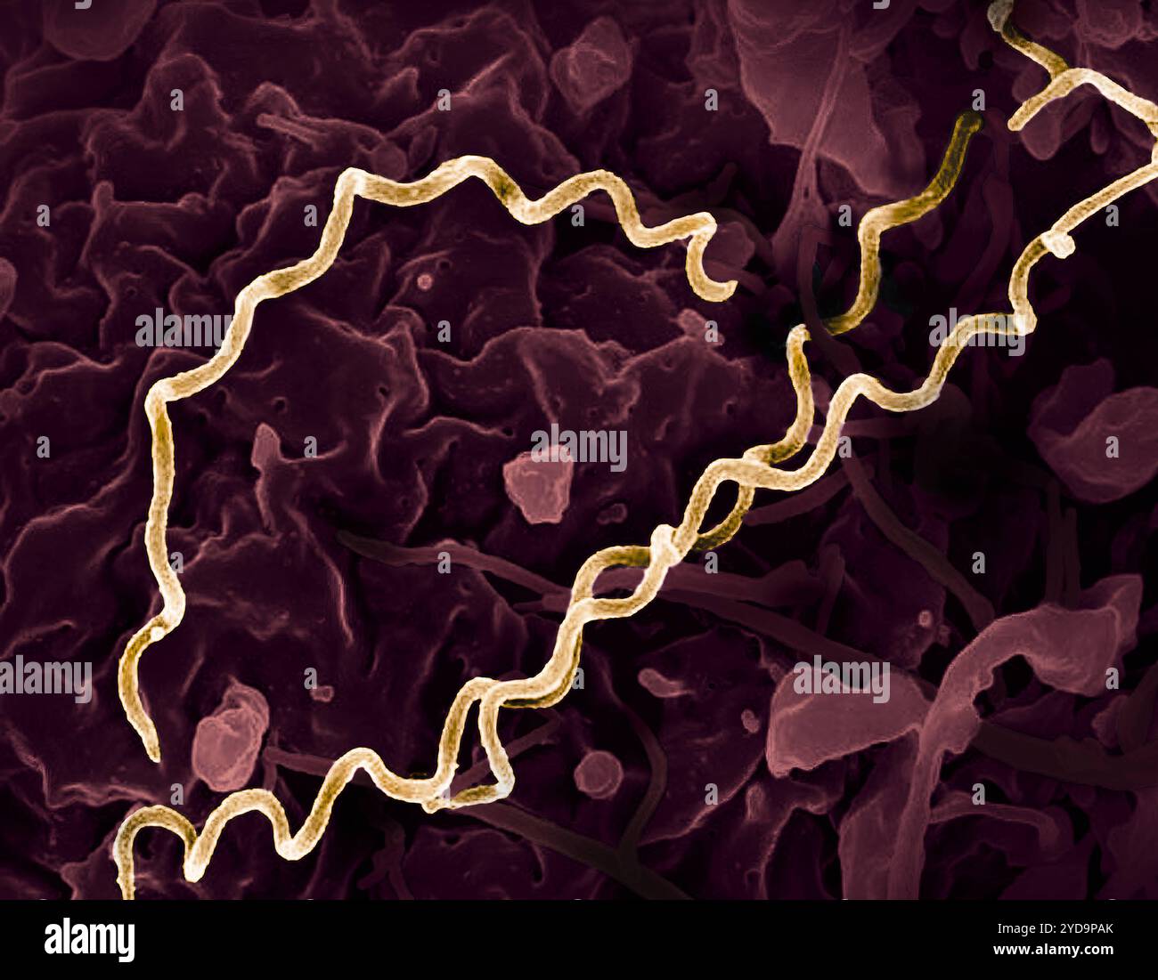 Colorized electron micrograph of Treponema pallidum, the bacteria that ...