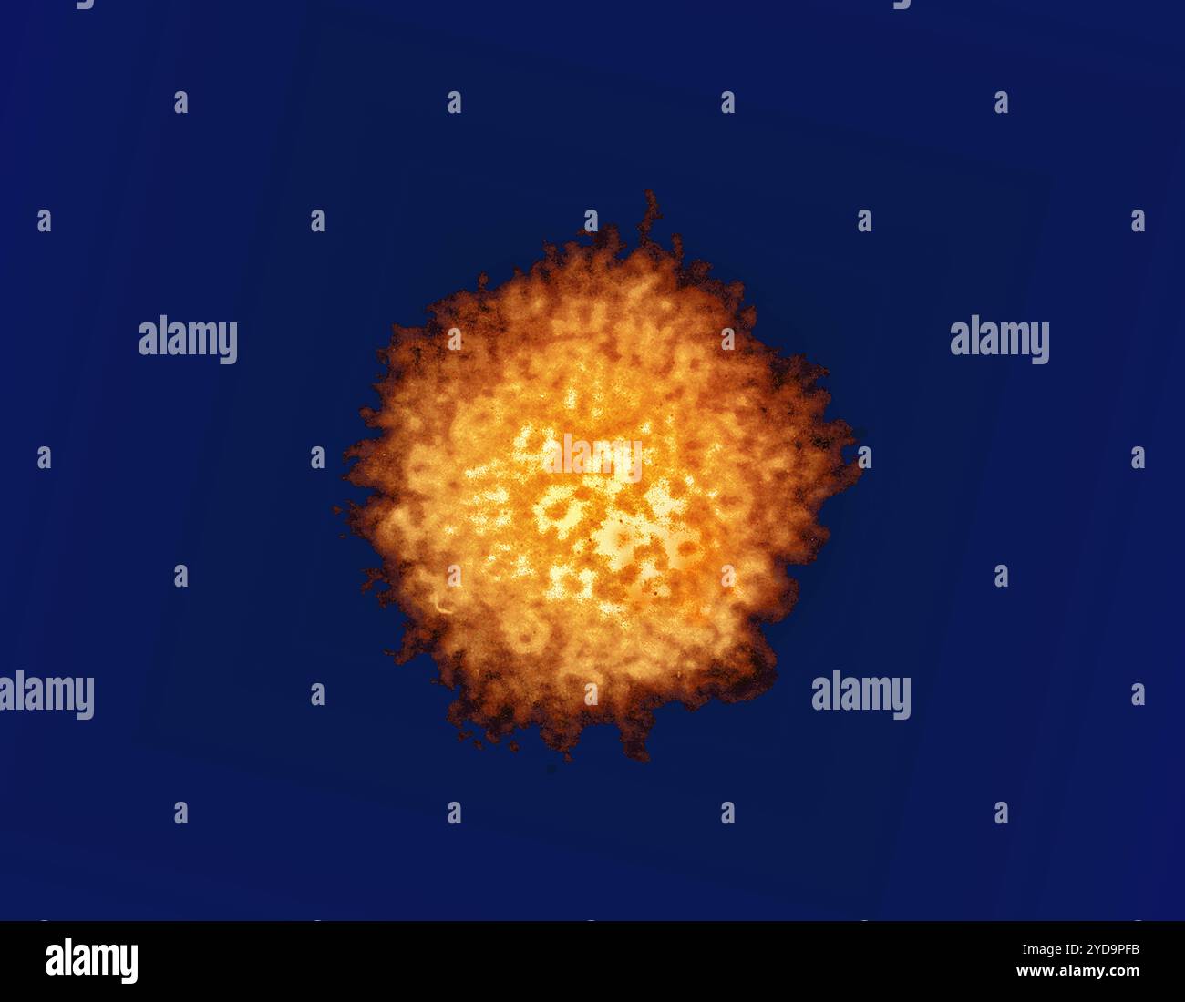 Colorized electron micrograph of the herpes simplex virus HSV. Herpes ...