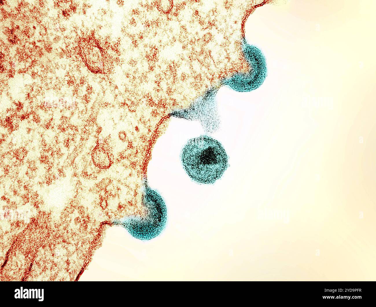 Transmission electron micrograph of HIV-1 virus particles teal from infected H9 cells, produced ...