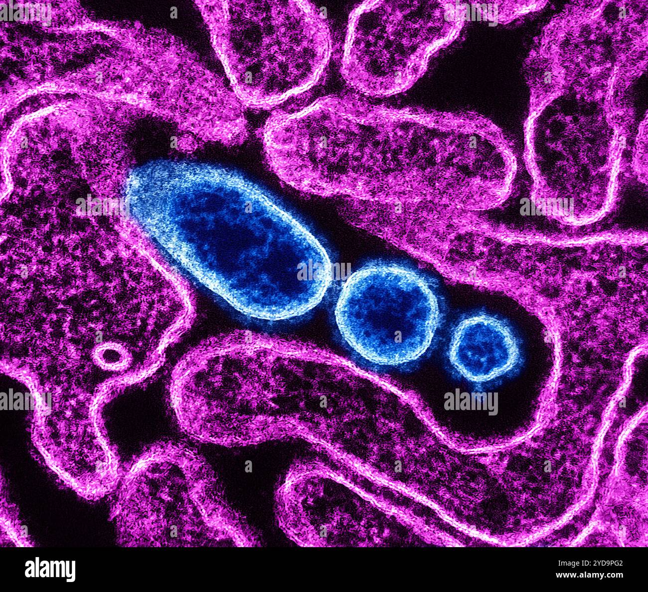 Colorized transmission electron micrograph of mature extracellular ...