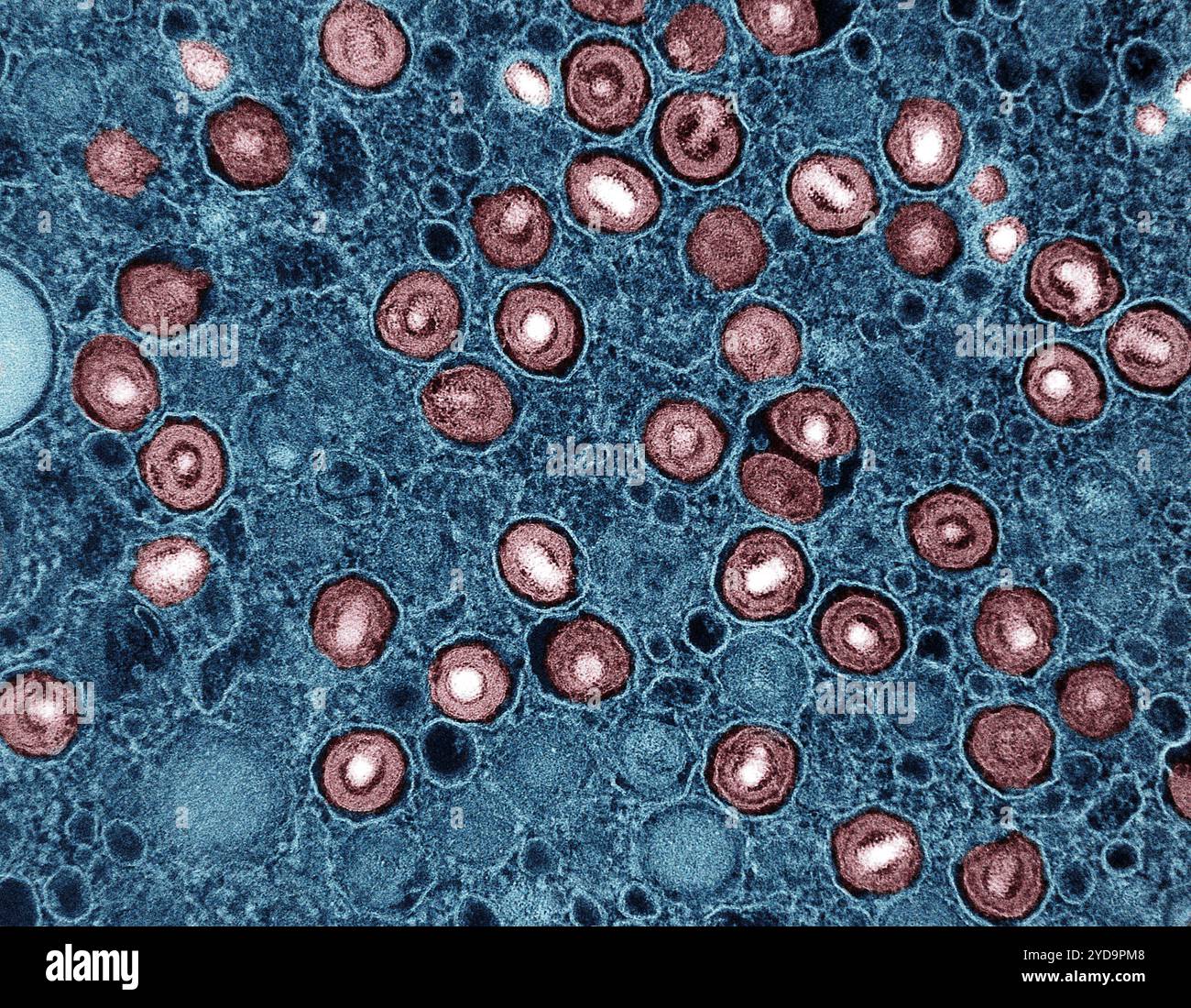 Transmission electron micrograph of cytomegalovirus CMV particles red ...