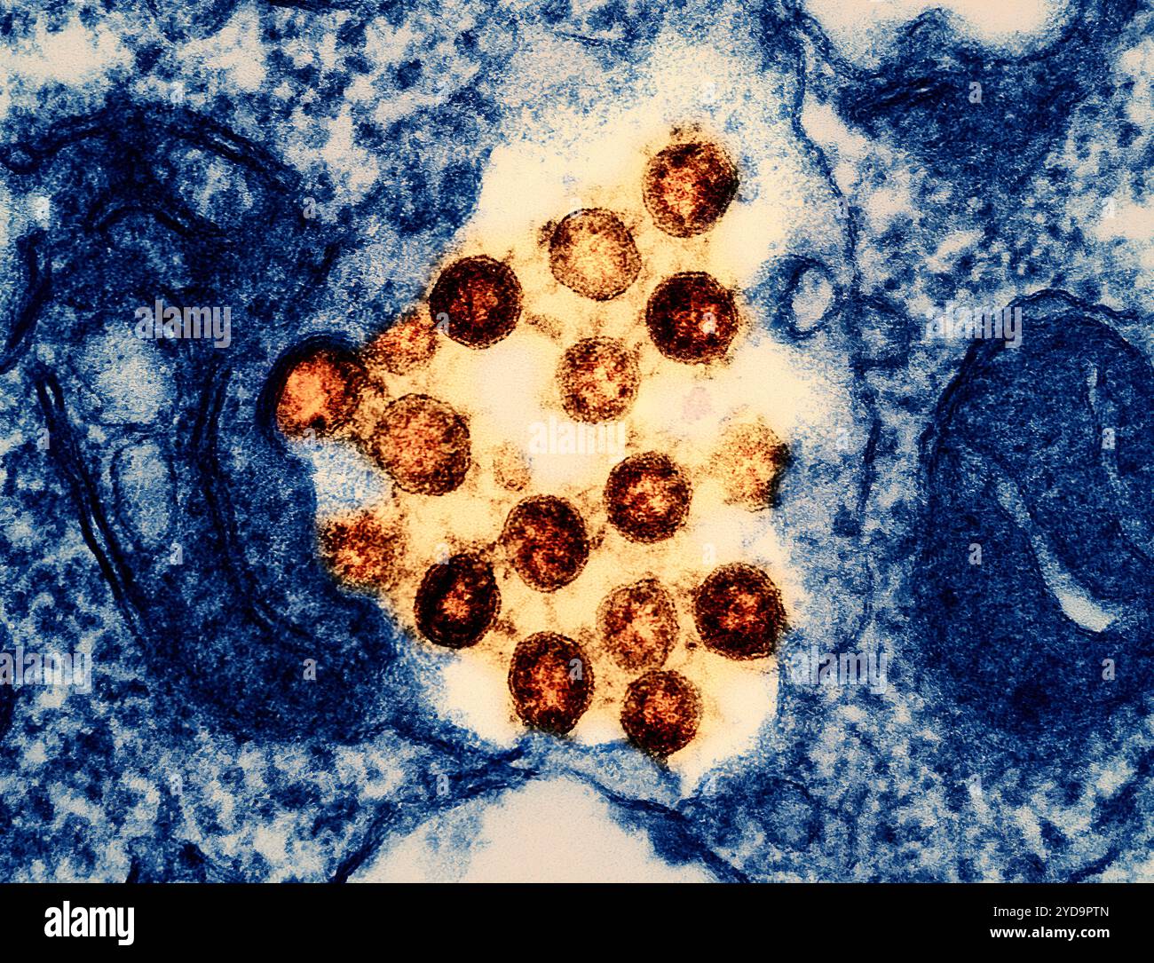 Transmission electron micrograph of SARS-CoV-2 virus particles ...