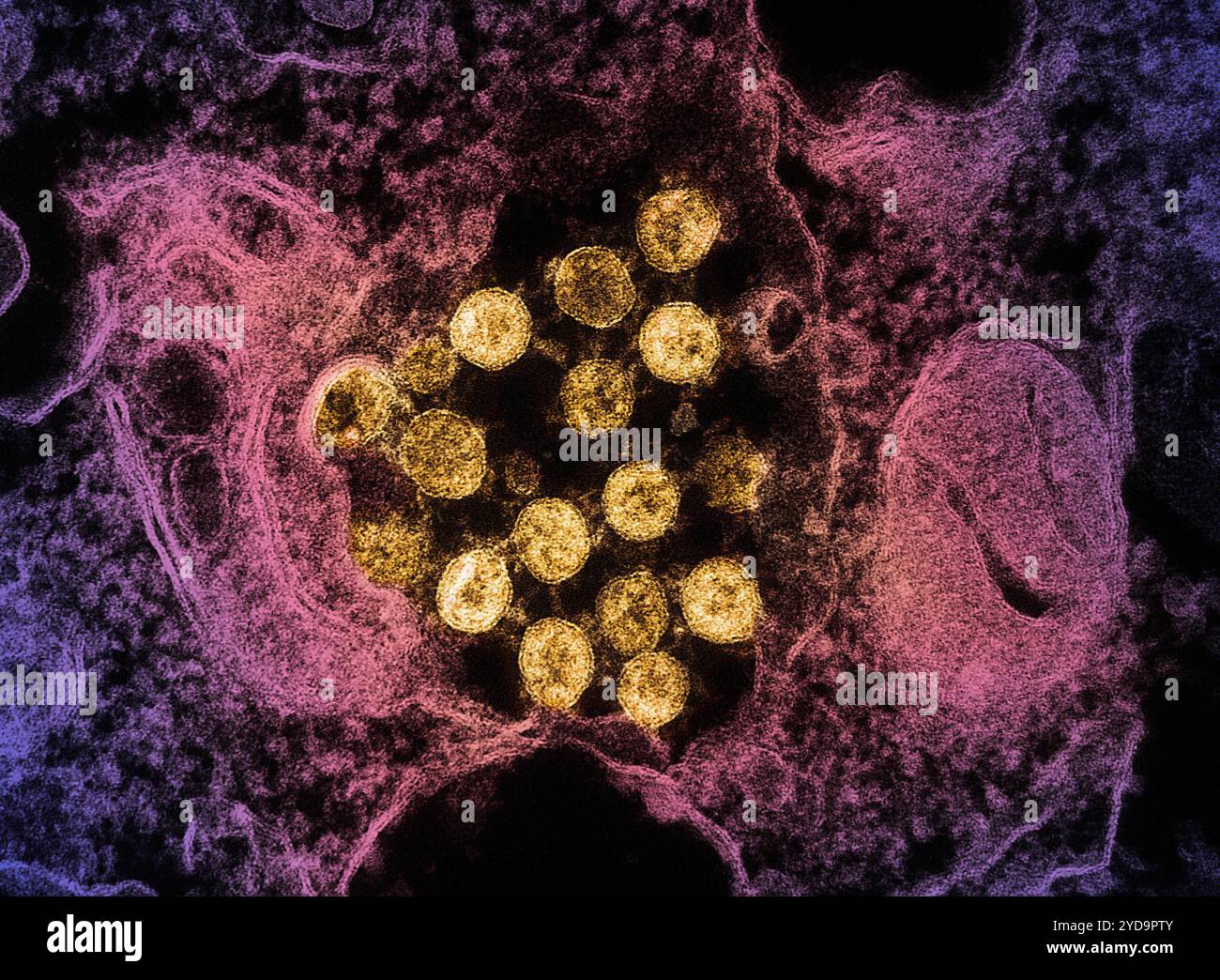 Transmission electron micrograph of SARS-CoV-2 virus particles ...