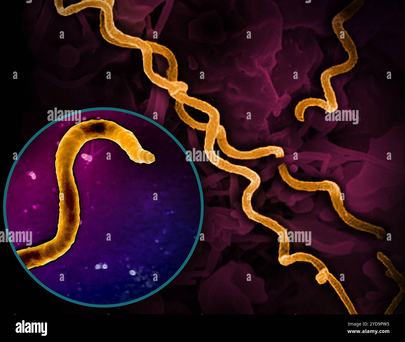 Spiral Bacteria