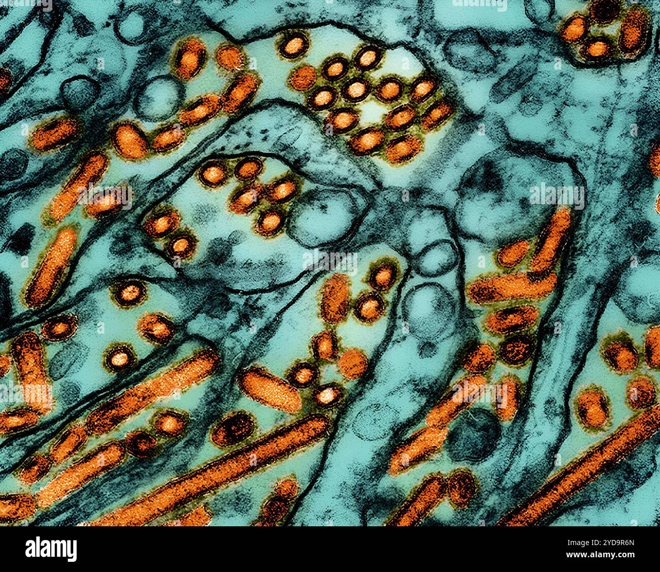 Colorized transmission electron micrograph of avian influenza A H5N1 ...