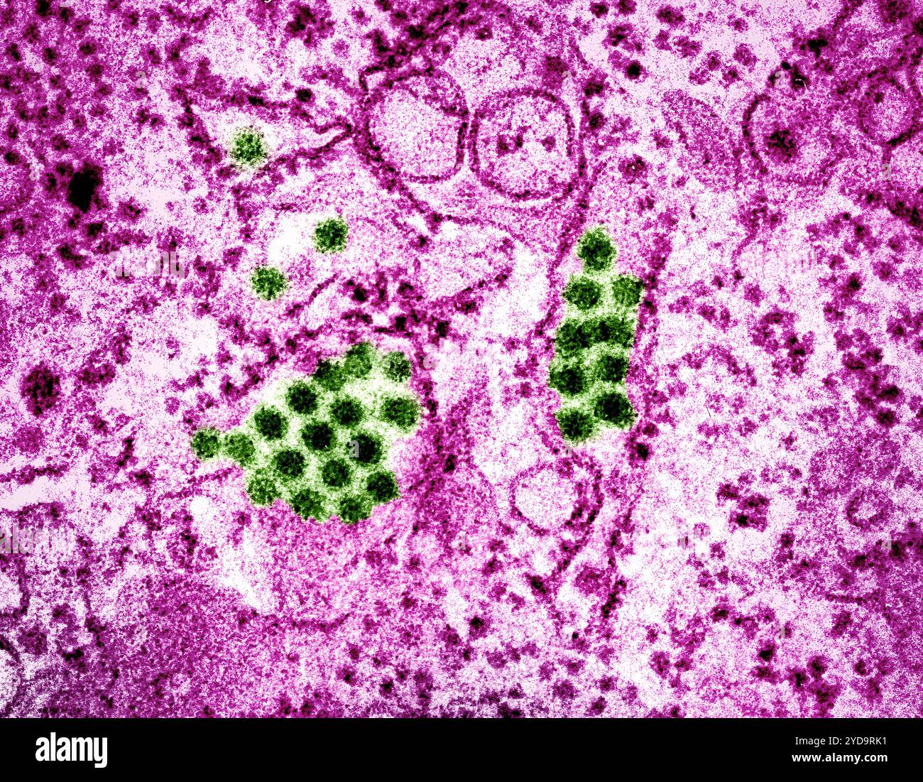 Transmission electron micrograph of dengue virus particles green ...