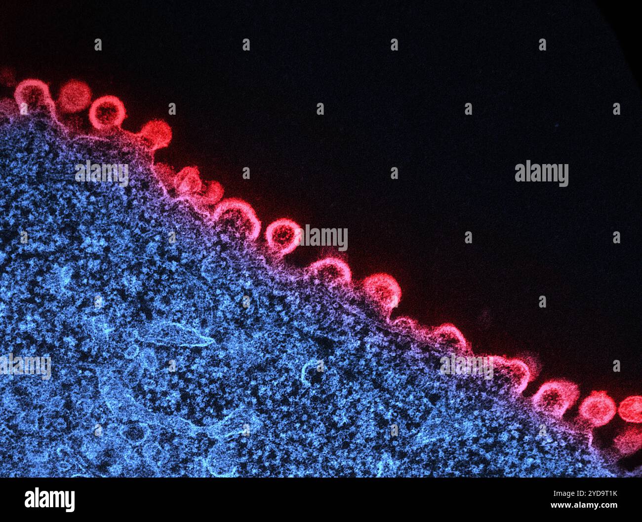 Colorized transmission electron micrograph of HIV-1 virus particles red ...