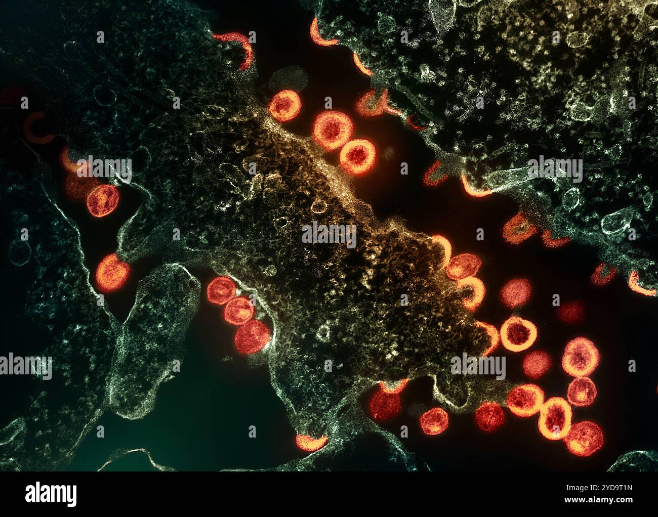 Transmission electron micrograph of HIV-1 virus particles red/gold ...
