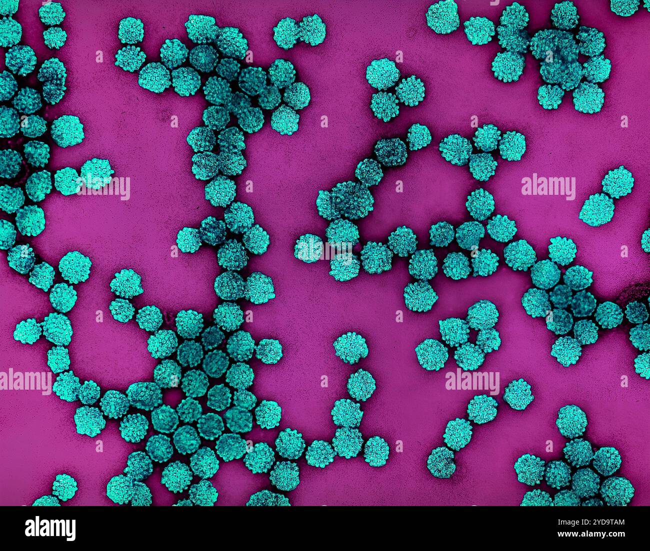 Colorized electron micrograph of HPV virus particles teal harvested and ...
