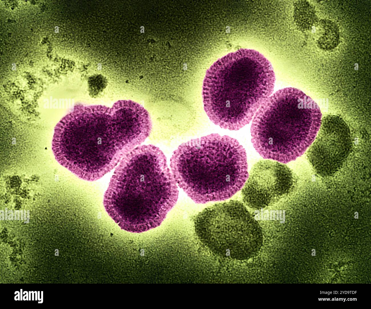 Colorized transmission electron micrograph of influenza A/H3N2 virus ...