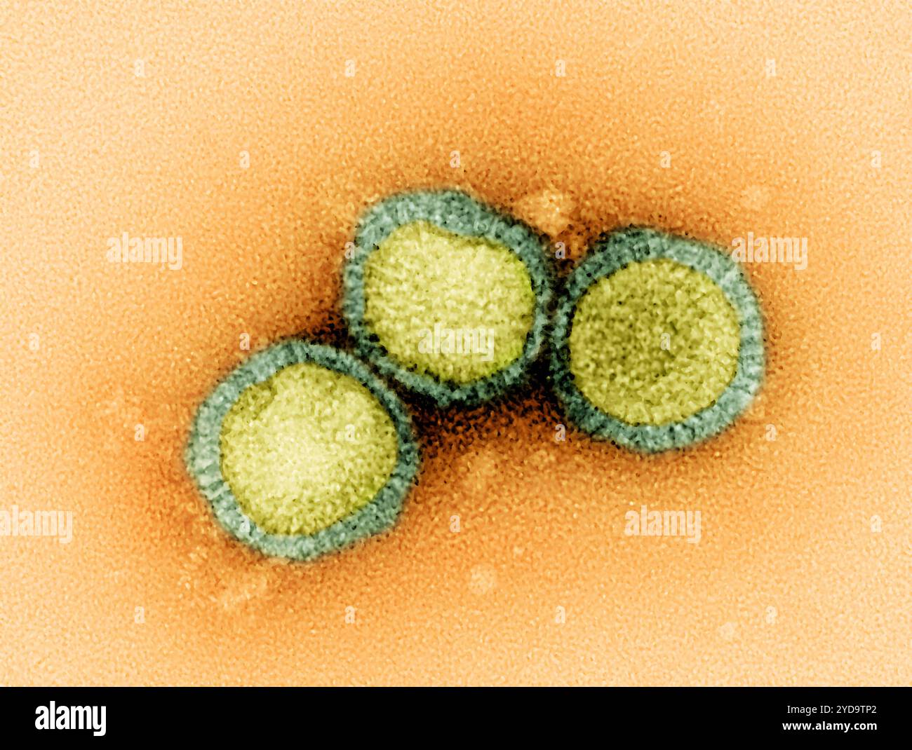 Seasonal viral diseases hi-res stock photography and images - Alamy