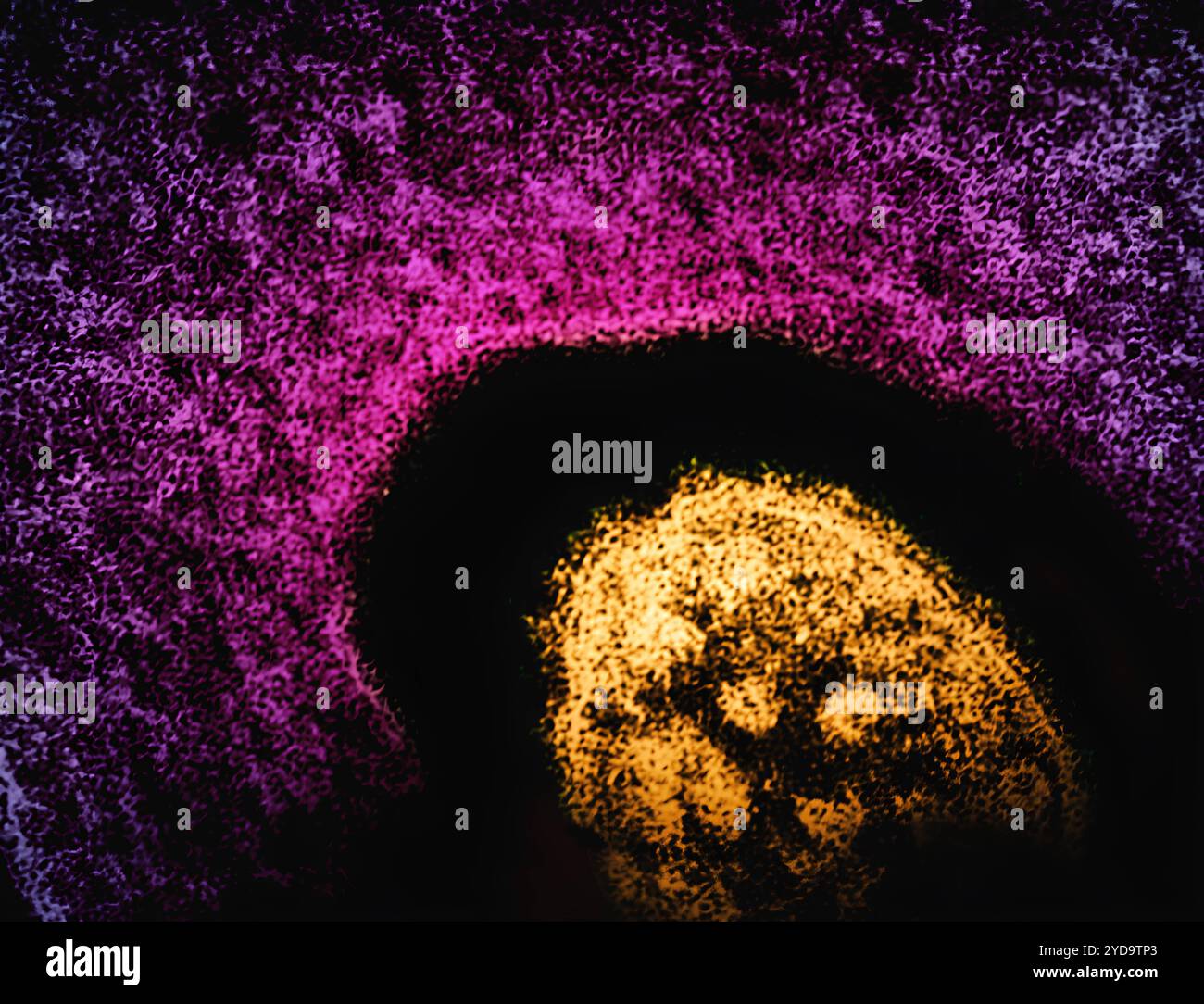 This transmission electron micrograph TEM revealed the ultrastructural ...