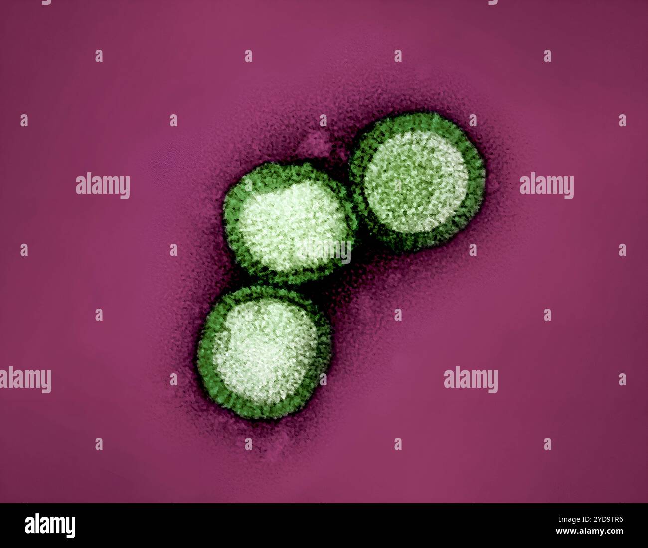 Influenza B virus particles green, isolated from a patient sample and ...