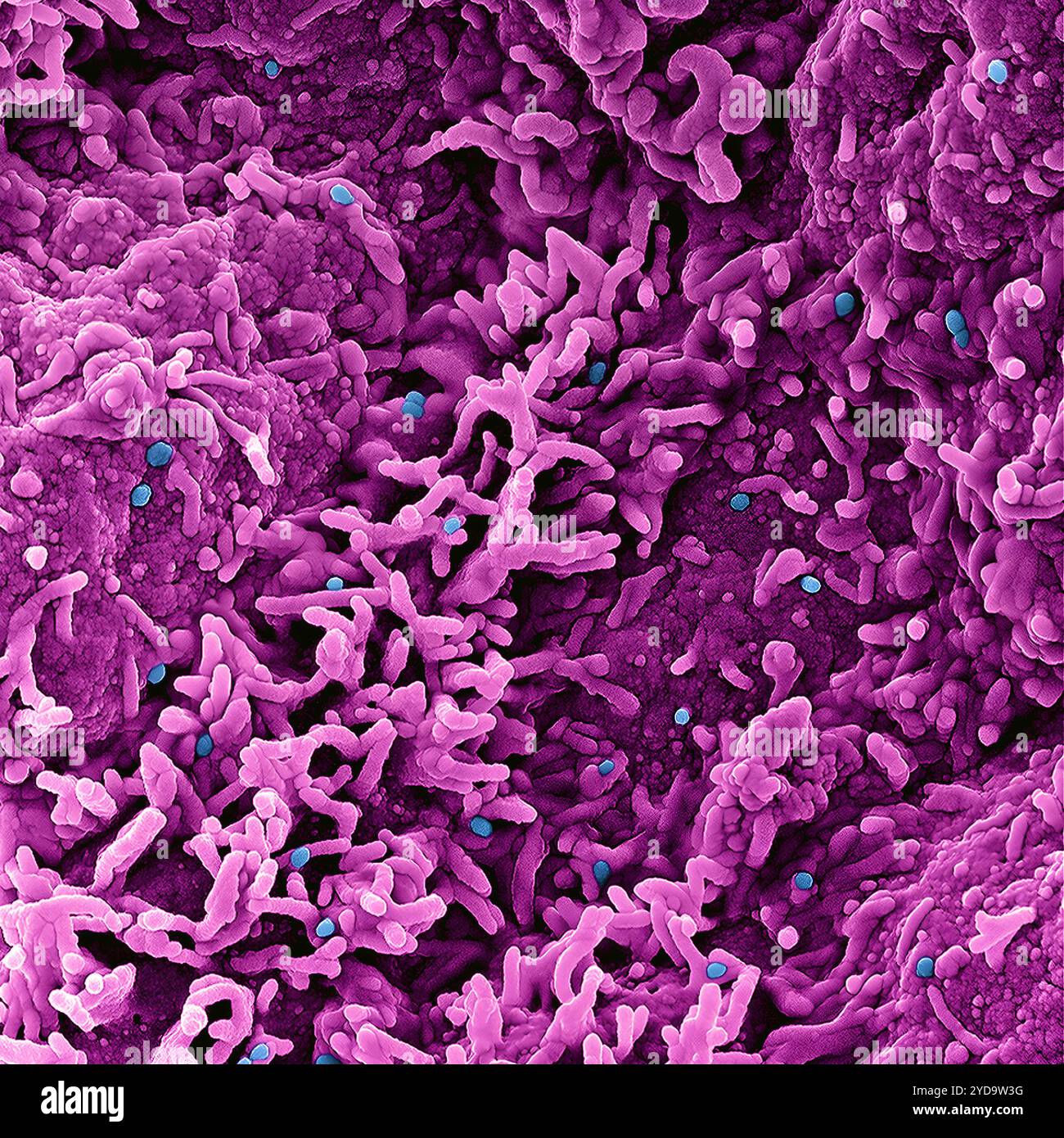 Colorized scanning electron micrograph of mpox virus particles blue on ...