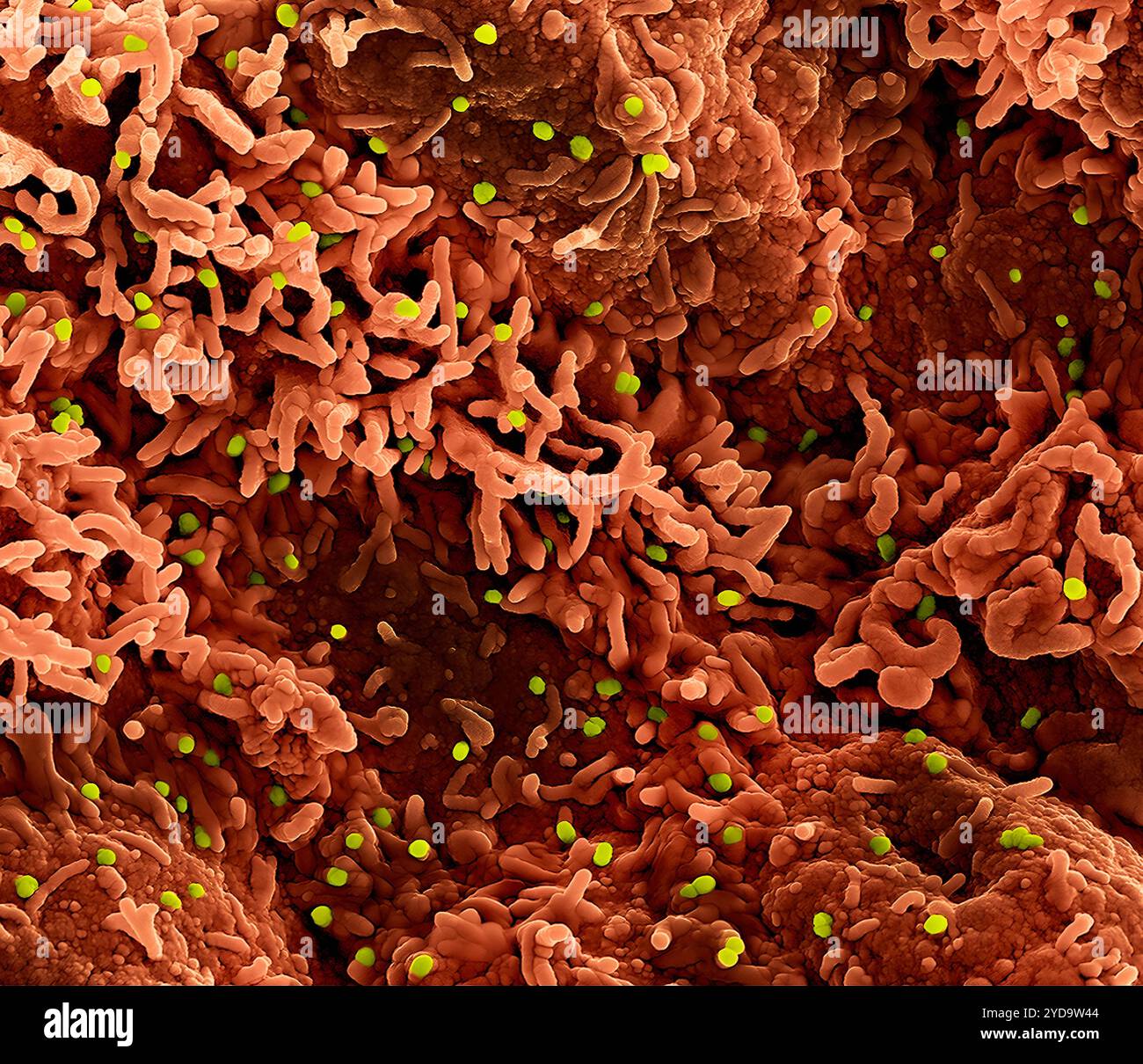 Colorized scanning electron micrograph of mpox virus particles green on ...