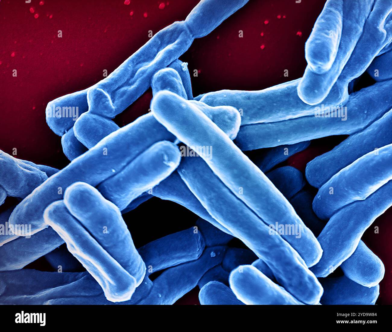Scanning electron micrograph of Mycobacterium tuberculosis particles ...