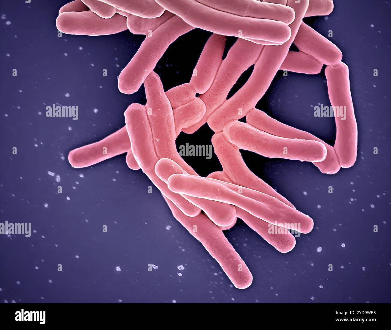 Scanning electron micrograph of Mycobacterium tuberculosis particles colorized pink, the ...