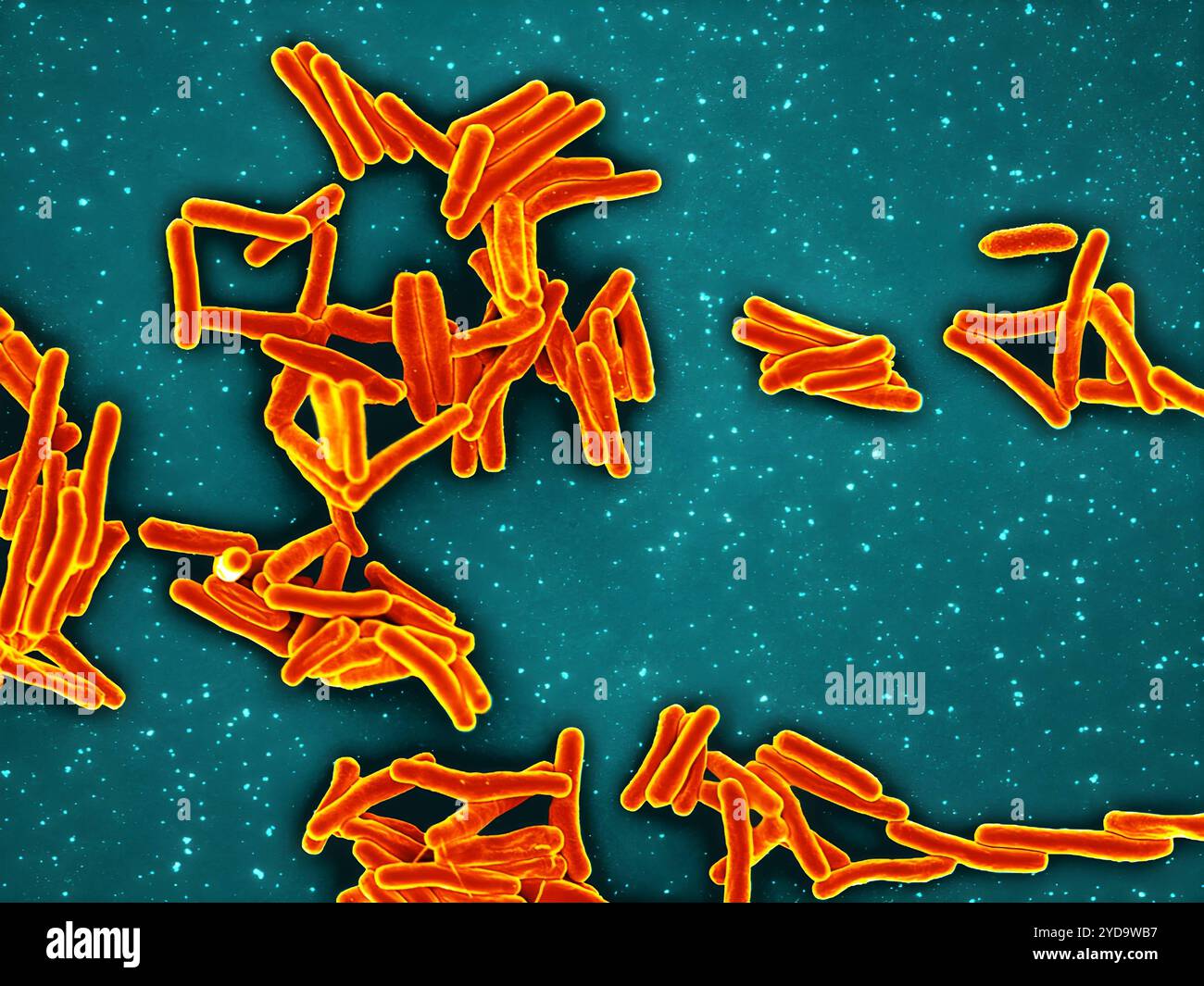 Scanning electron micrograph of Mycobacterium tuberculosis particles colorized red/yellow, the ...