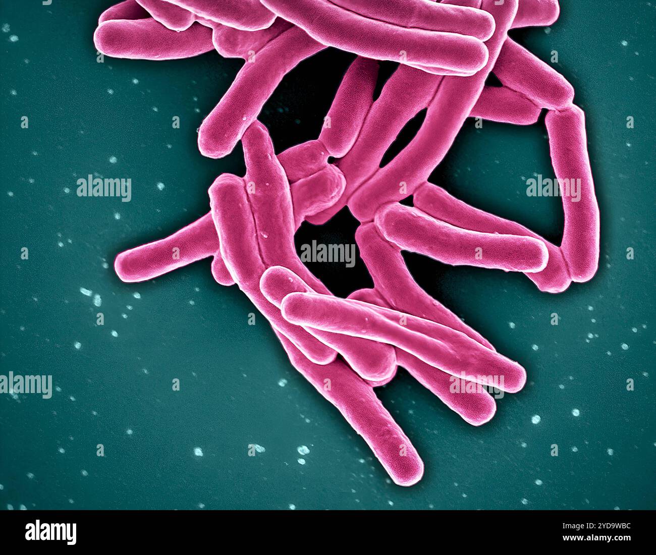 Scanning electron micrograph of Mycobacterium tuberculosis particles colorized pink, the ...
