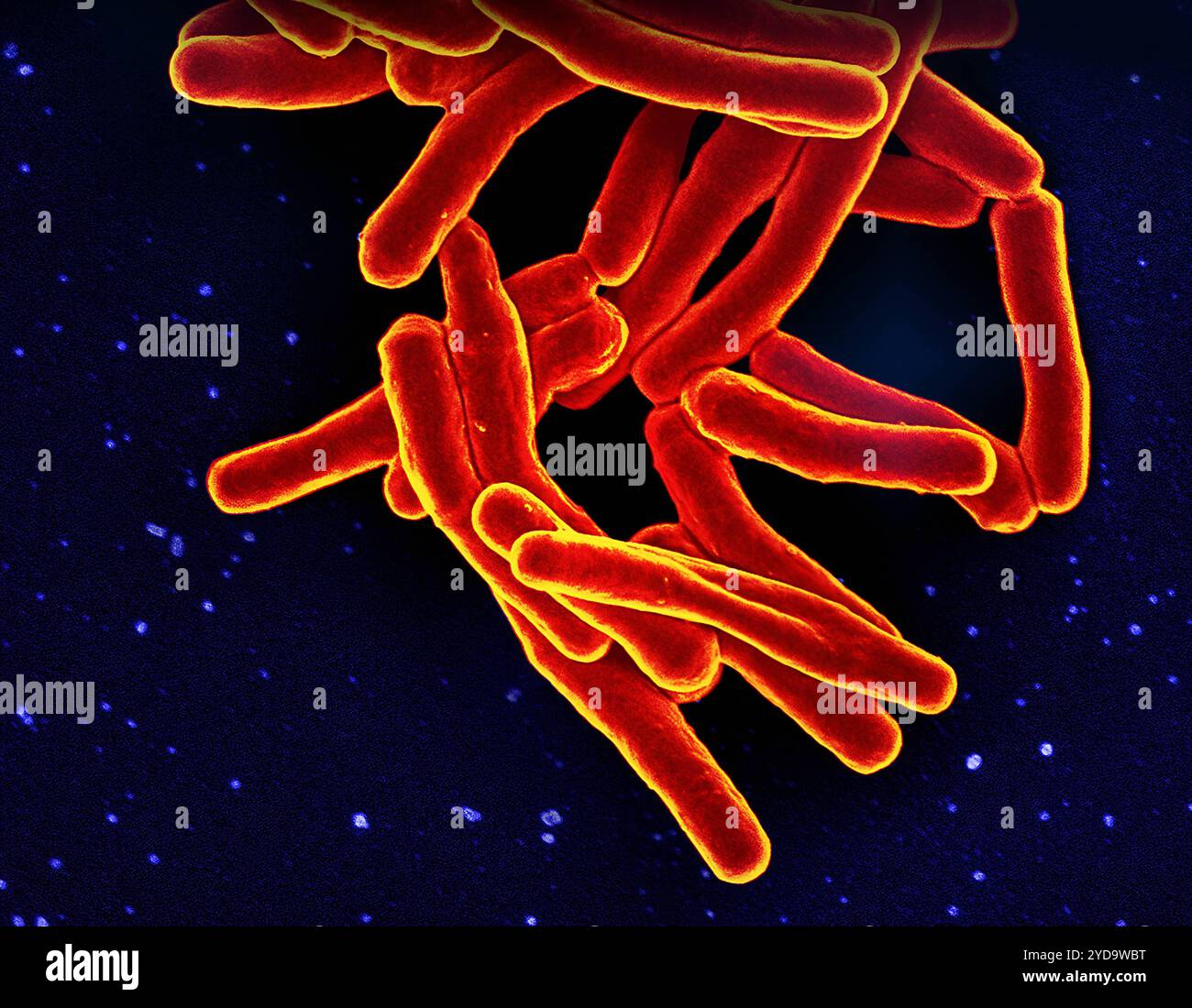 Scanning electron micrograph of Mycobacterium tuberculosis particles ...