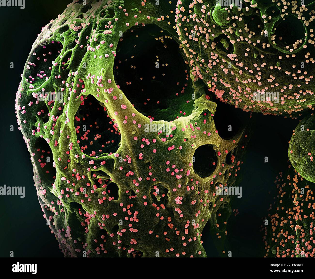 Colorized scanning electron micrograph of a cell green infected with ...
