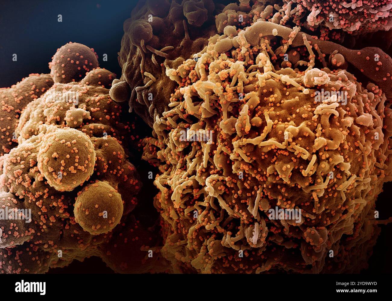 Colorized scanning electron micrograph of a cell brown infected with ...