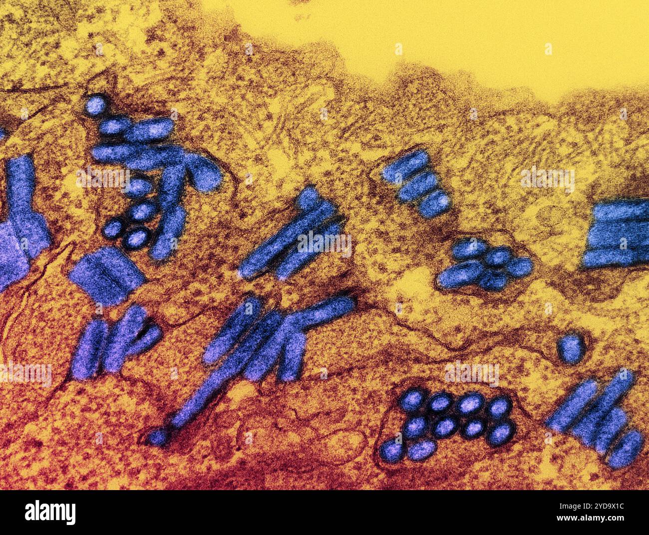 Colorized transmission electron micrograph of rabies virus particles ...