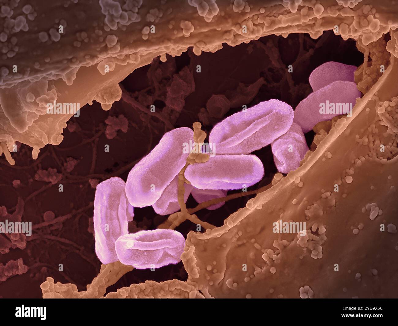 Scanning electron micrograph of Rickettsia typhi bacteria. Rickettsia ...