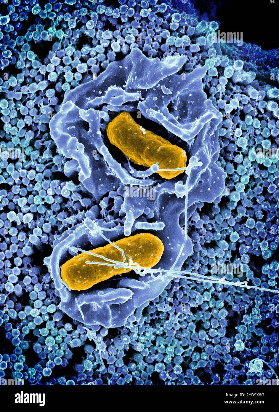 Scanning electron micrograph of Salmonella Typhimurium invading a human ...