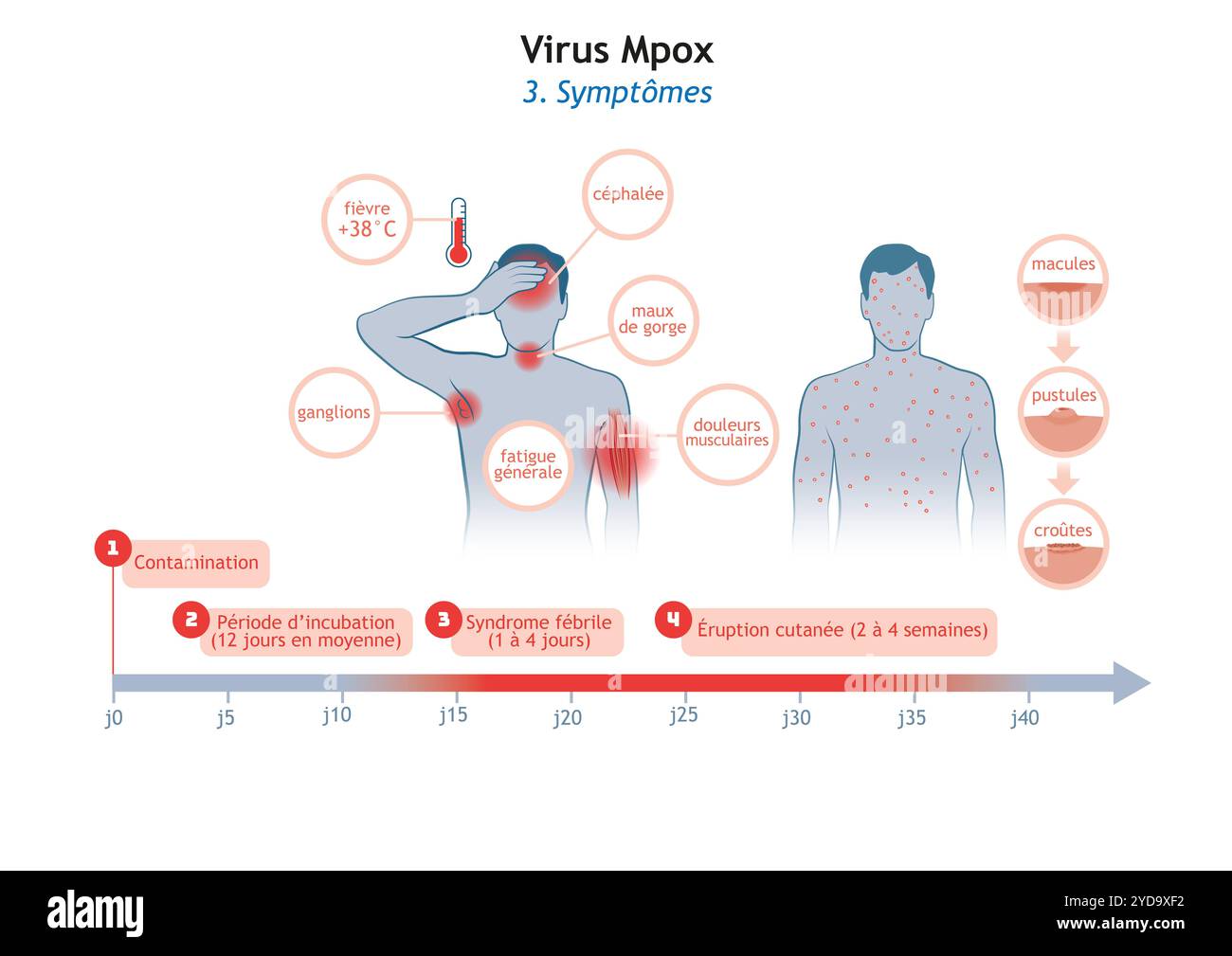 Mpox virus hi-res stock photography and images - Alamy