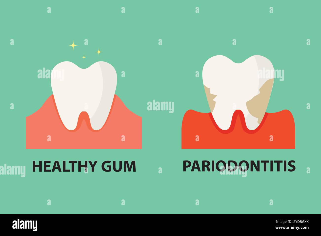Stomatological concept. Comparison between healthy tooth and ...