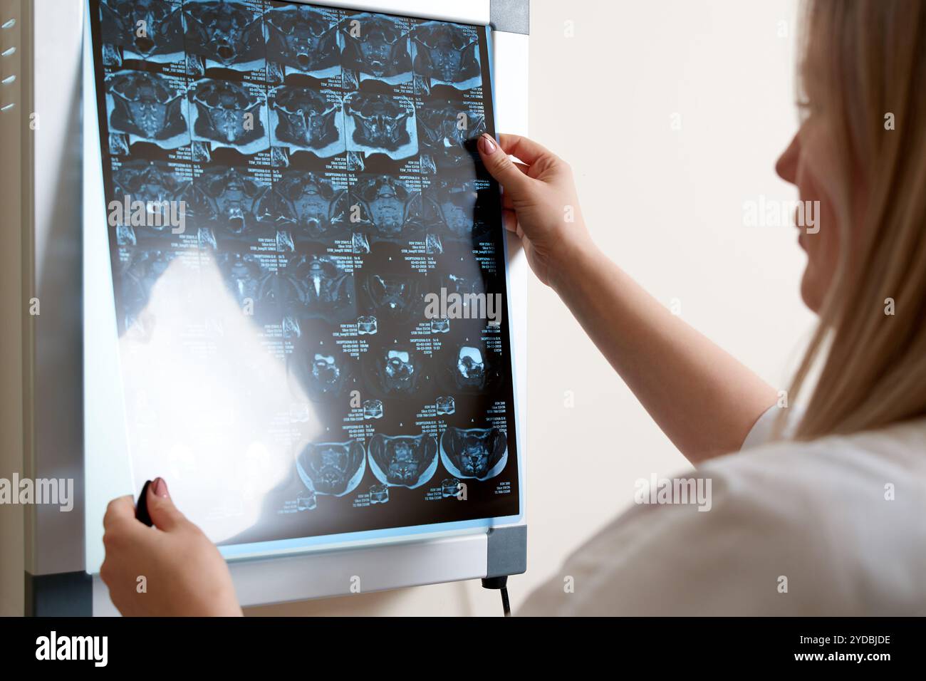 Doctor looking at x-ray image on screen in clinic Stock Photo - Alamy