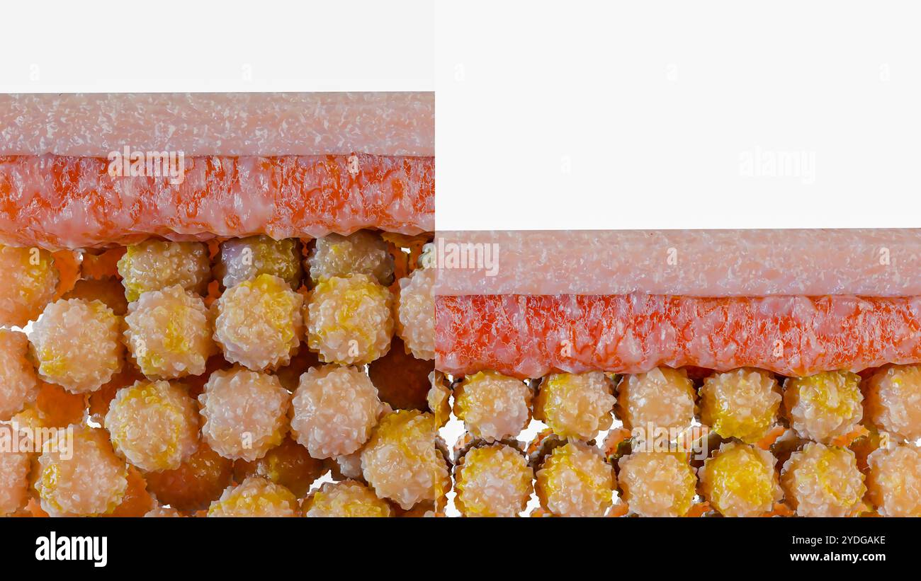 Weight loss Comparison. man body transformation. Before and after a ...