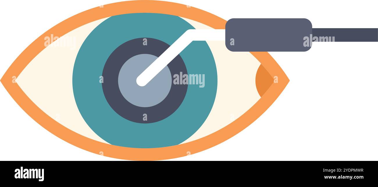 Laser is being used to perform a laser eye surgery to correct vision ...