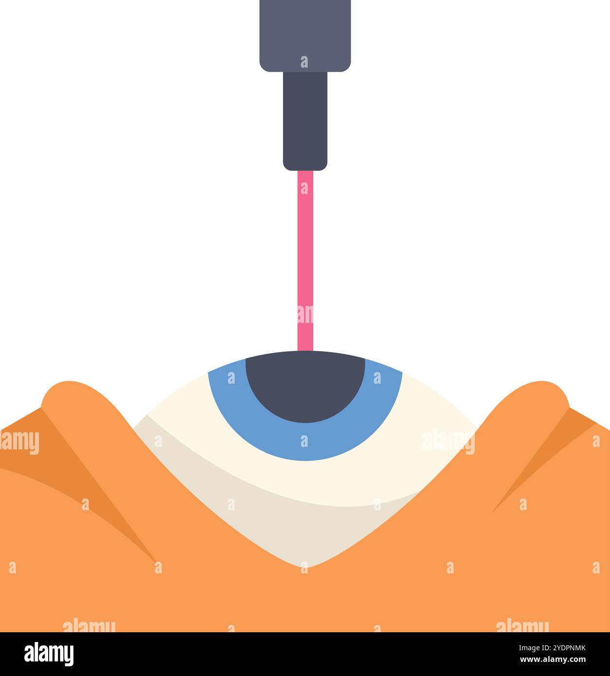 Laser surgery correcting vision problems by operating on the cornea to ...