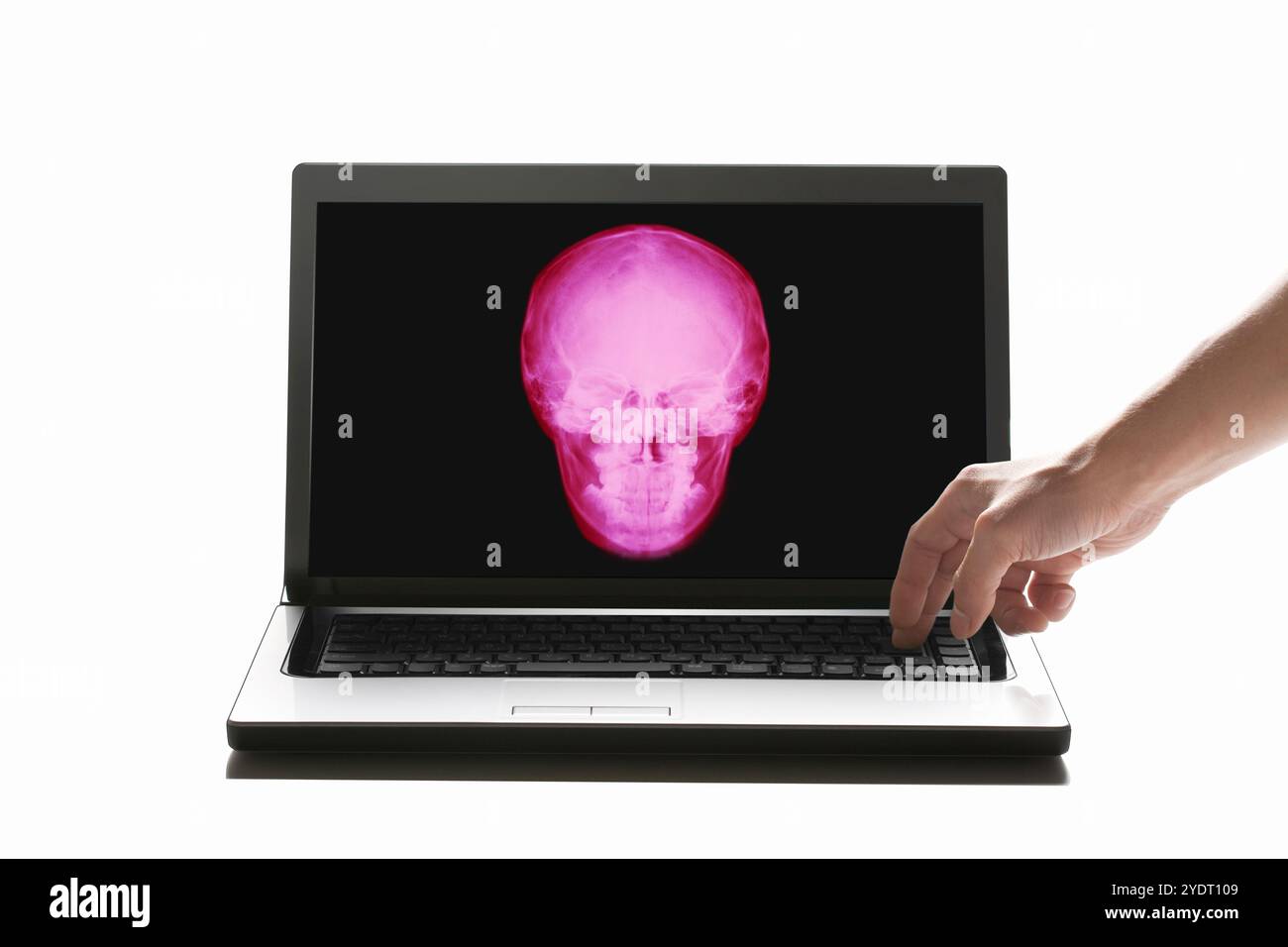 X-rays on the monitor Stock Photo - Alamy