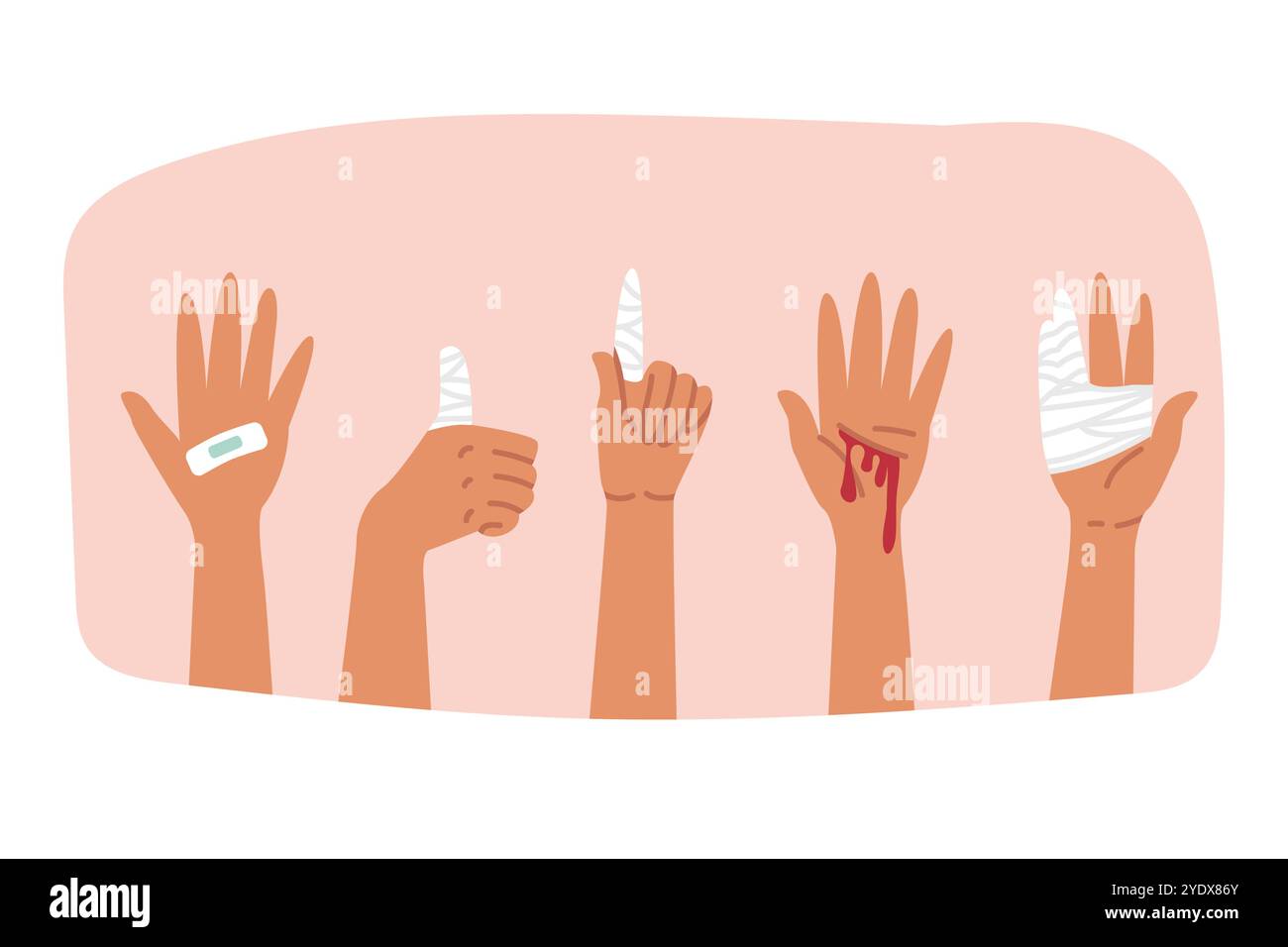 Arm covered in plaster Cut Out Stock Images & Pictures - Alamy