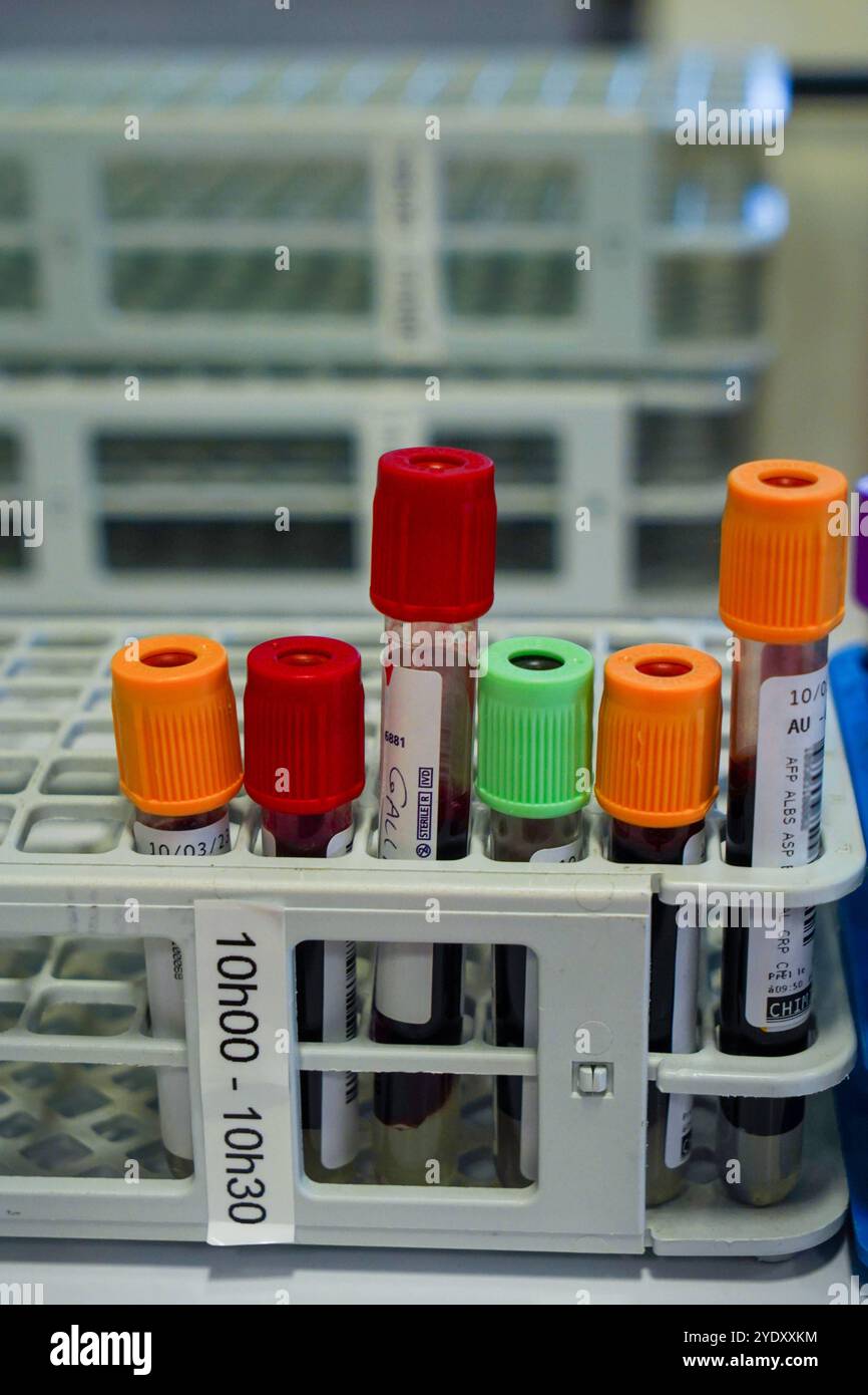 Blood probe hi-res stock photography and images - Alamy