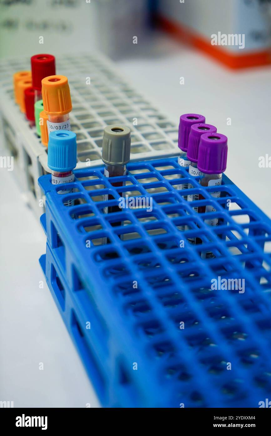 Medical analysis laboratory. Blood samples before analysis. Medical ...