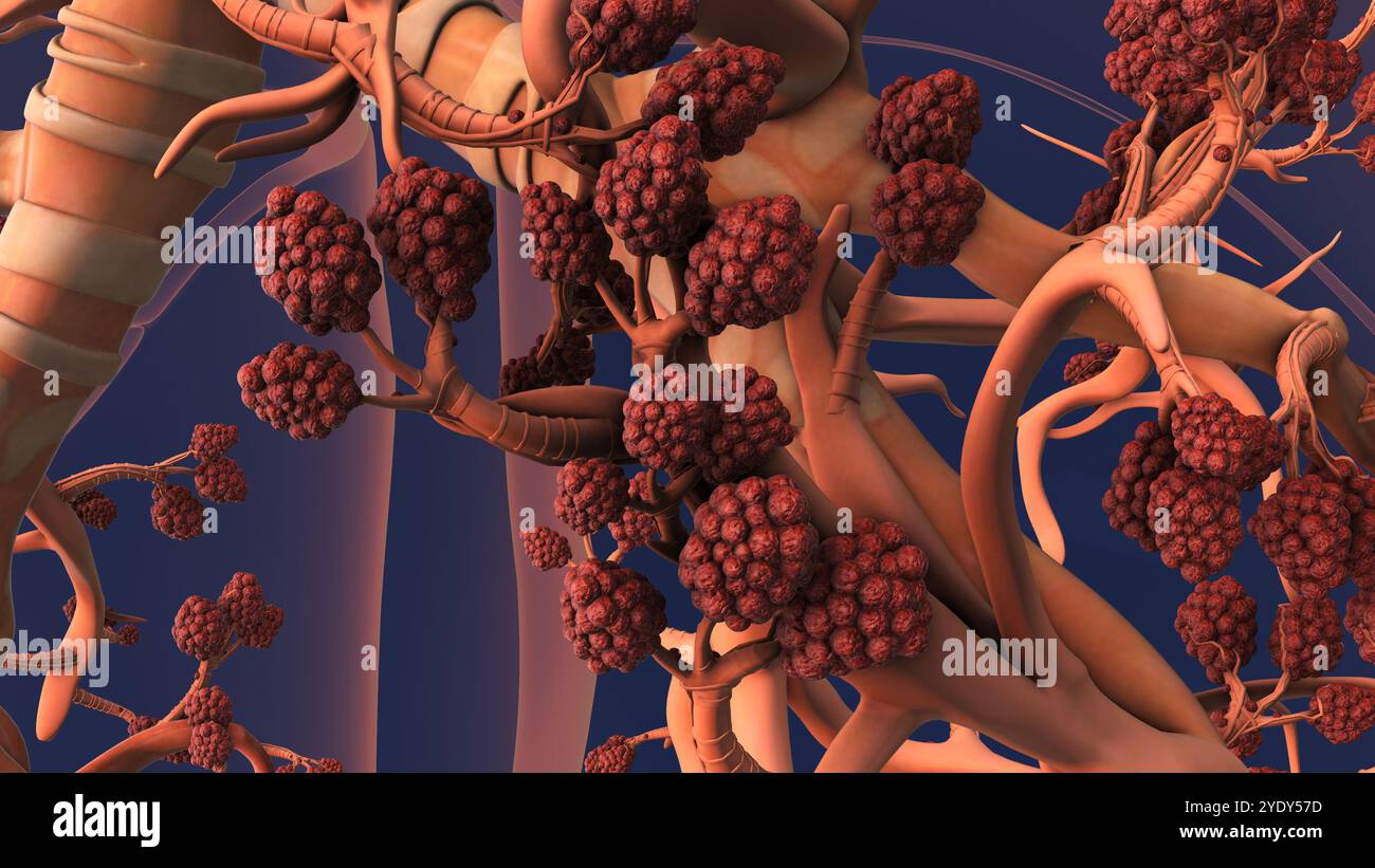 Alveoli in Lungs Facilitating Respiration and Oxygenation Stock Photo ...