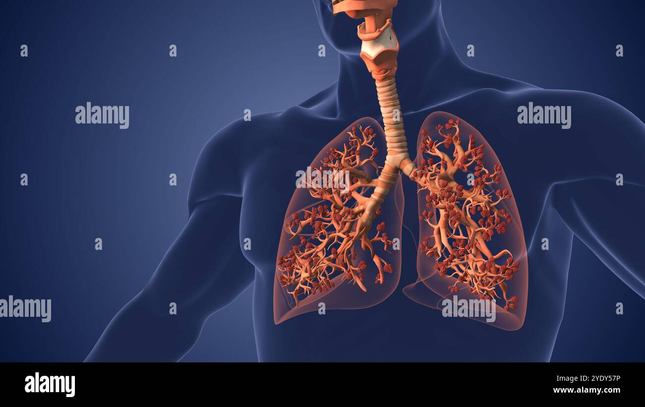 Alveoli of lungs hi-res stock photography and images - Alamy