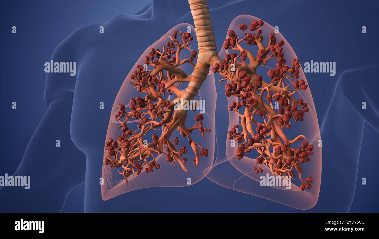 Lungs respiration oxygen exchange hi-res stock photography and images - Alamy