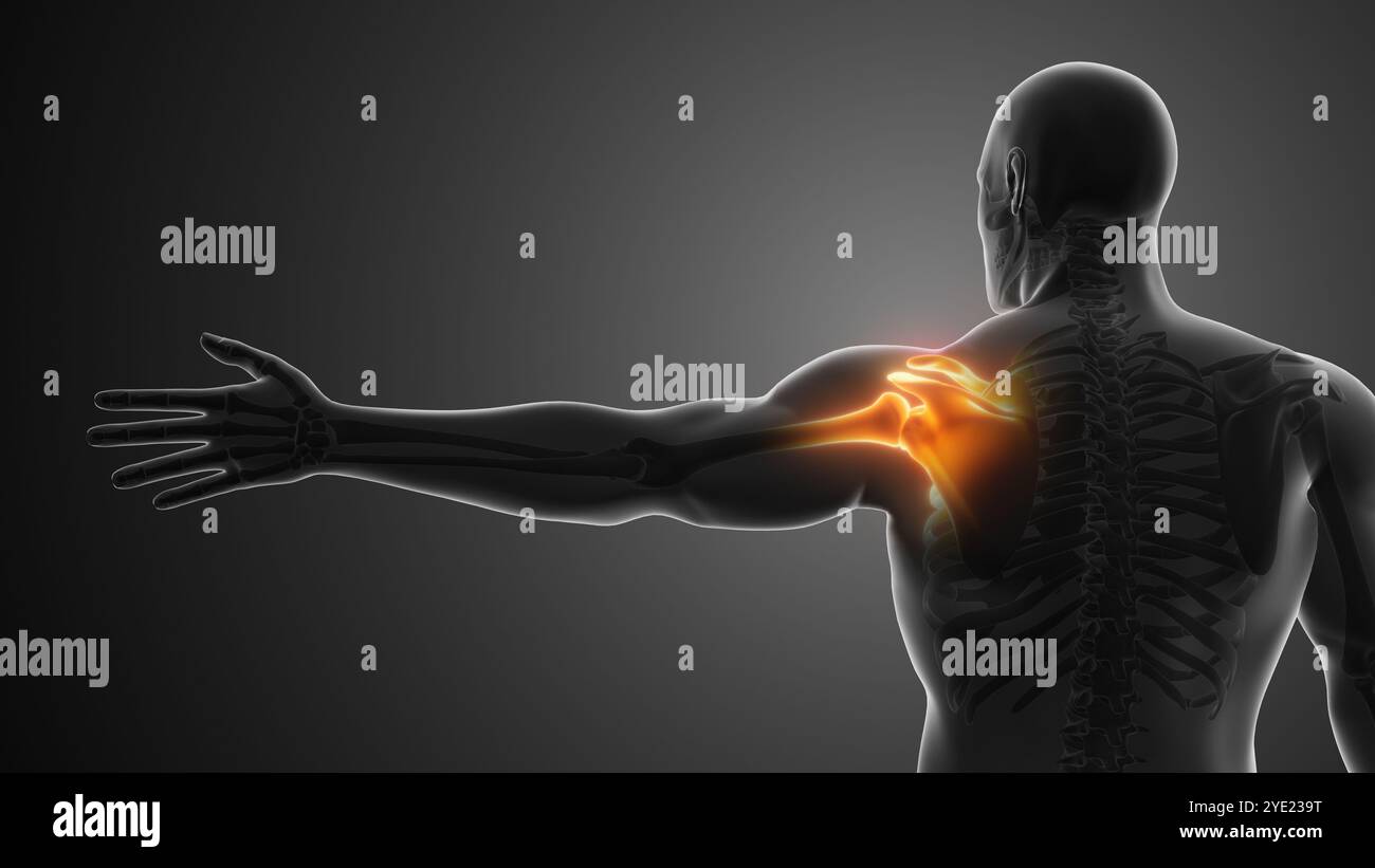 Medical Animation of Shoulder Bone Pain Disorders Stock Photo - Alamy