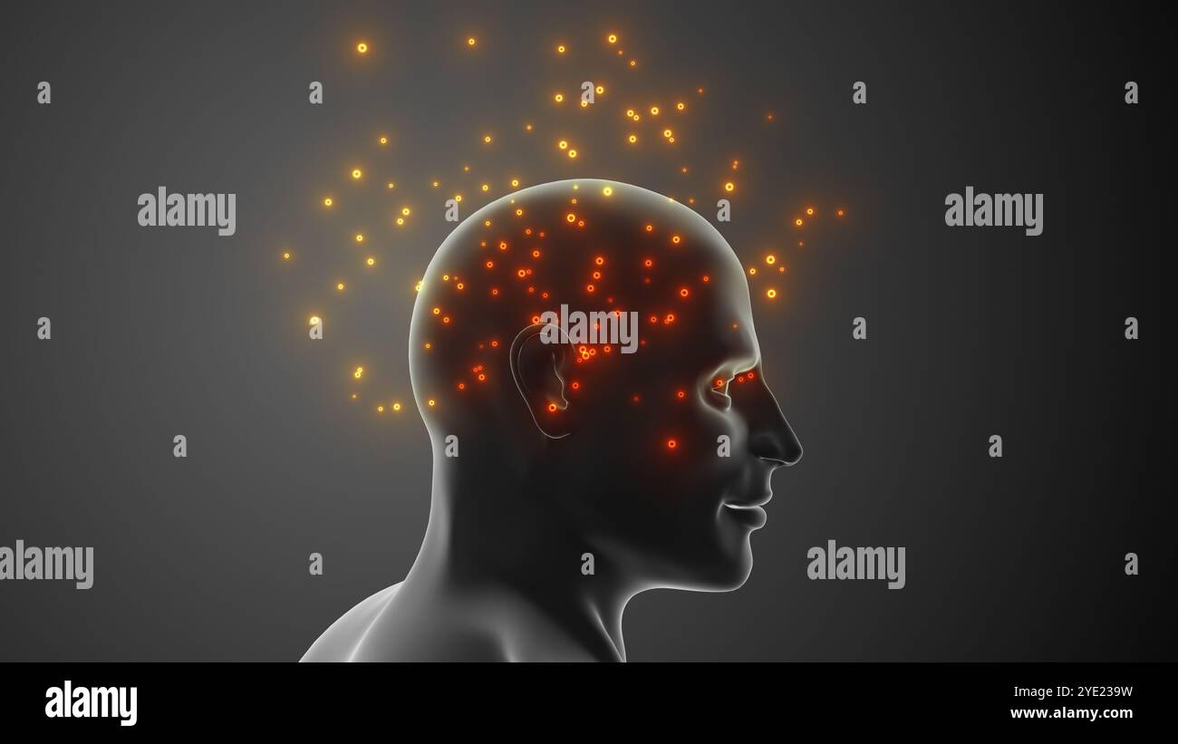 Mental Overload Causing Head Discomfort Stock Photo - Alamy