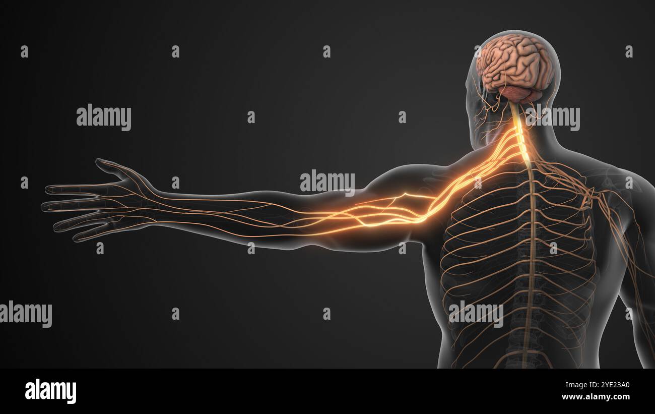 Nerve Compression in Neck Causing Radiculopathy Stock Photo - Alamy