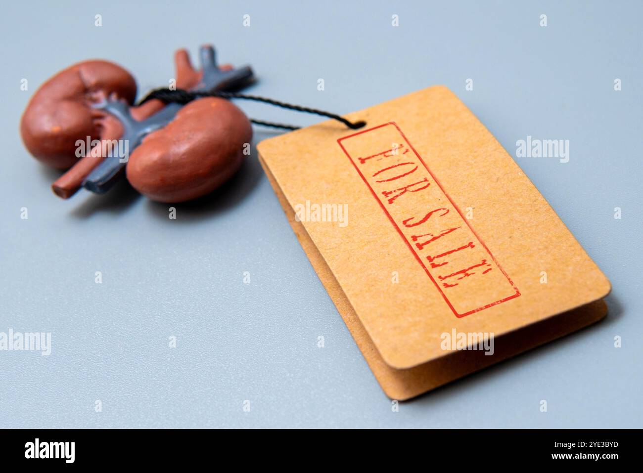 A pair of kidneys with a for sale tag. Organ trafficking and the ...