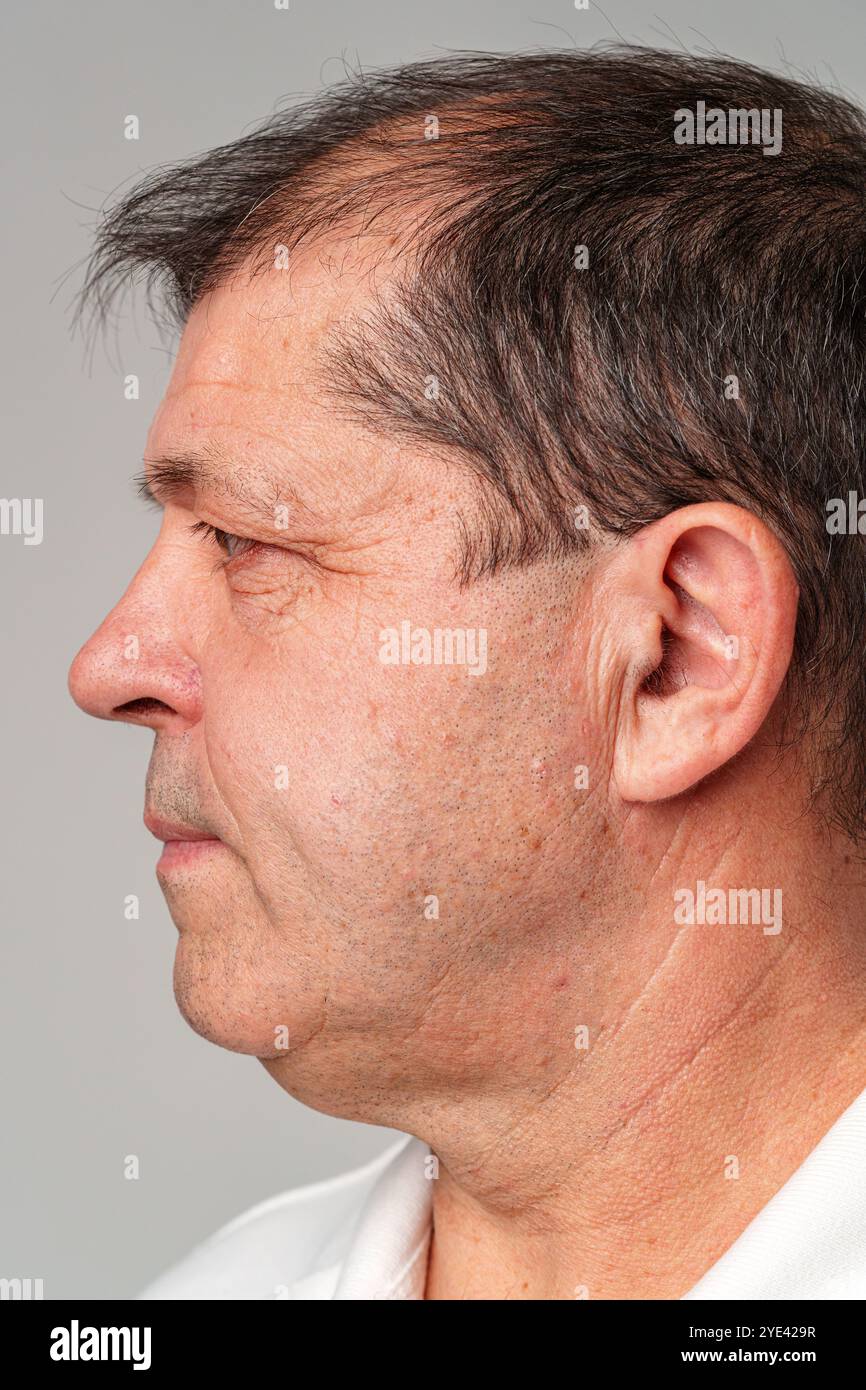 Intricate physical characteristics hi-res stock photography and images ...