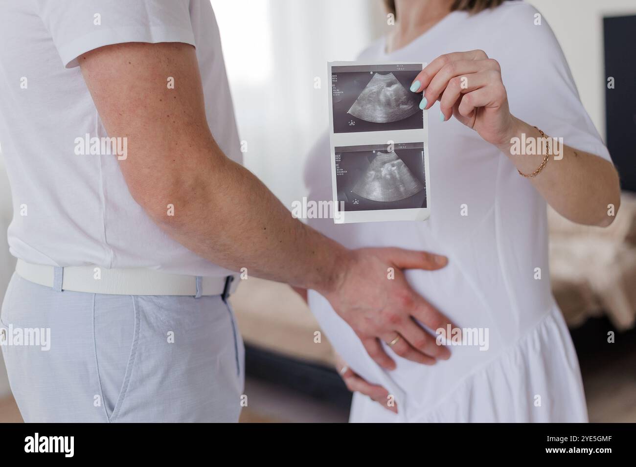Expectant Parents Announcing Pregnancy with Ultrasound Images Stock ...