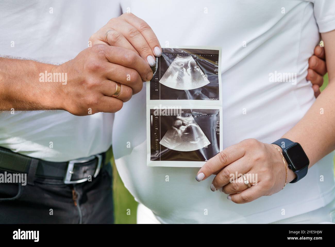 Ultrasound reveal hi-res stock photography and images - Alamy